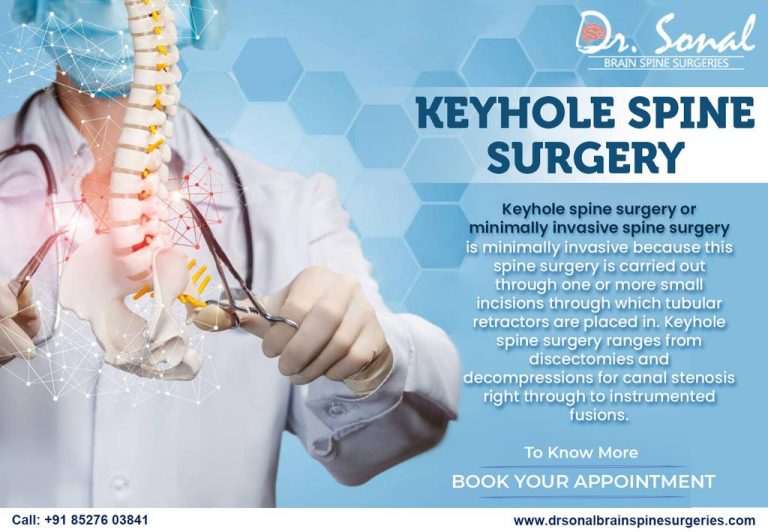 What do I need to Know About Spinal Surgeries? - Dr. Sonal Gupta